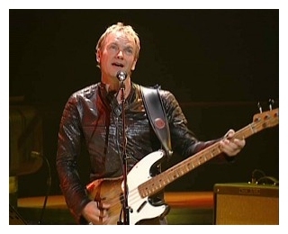 Sting